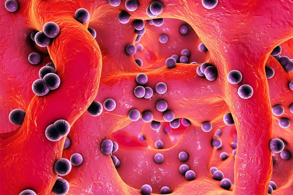 Diabetic Wounds in Los Angeles, CA | Diabetic Foot Ulcers