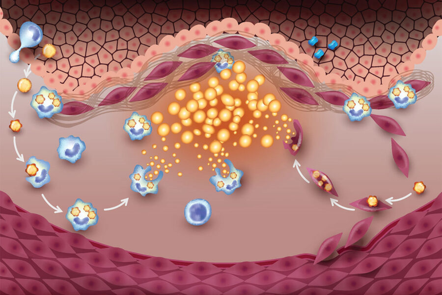 Arterial Wounds in Los Angeles, CA | Wound & Burn Centers