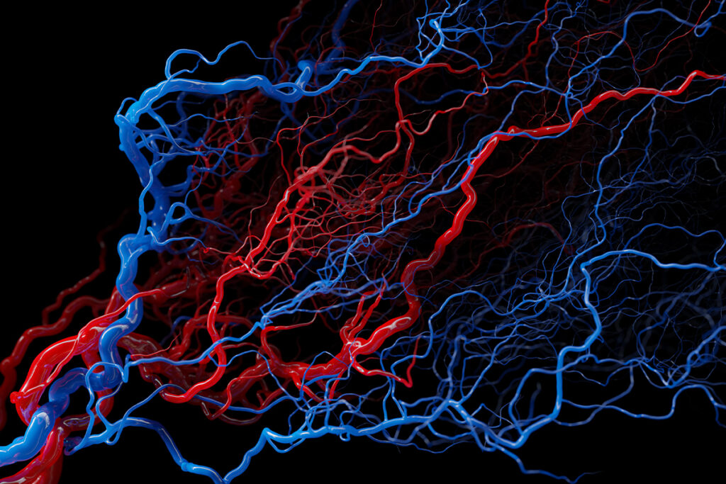 Limb Preservation in Los Angeles, CA | Wound & Burn Centers