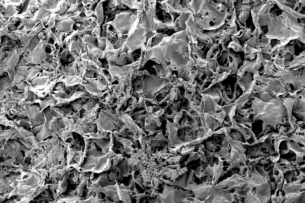 Scar Treatment in Los Angeles, CA | Wound & Burn Centers