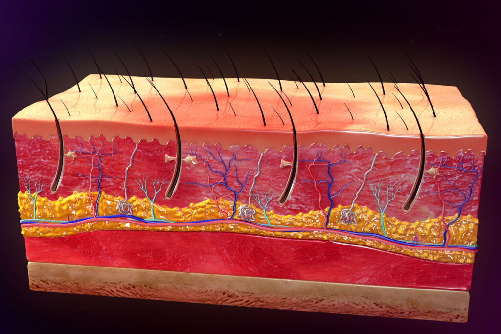 Burn Injuries Los Angeles, CA | Wound & Burn Centers of America