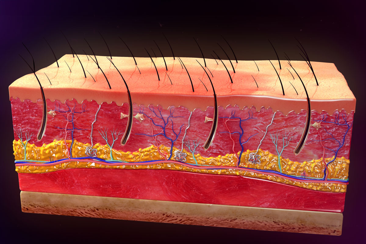 Burn Injuries Los Angeles, CA | Wound & Burn Centers of America